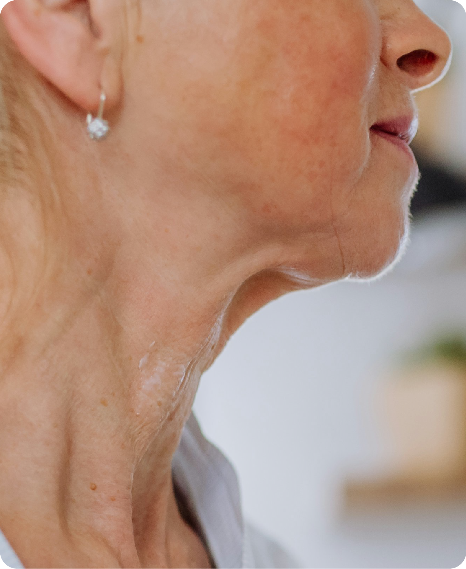 Education – BIOFLEX Laser